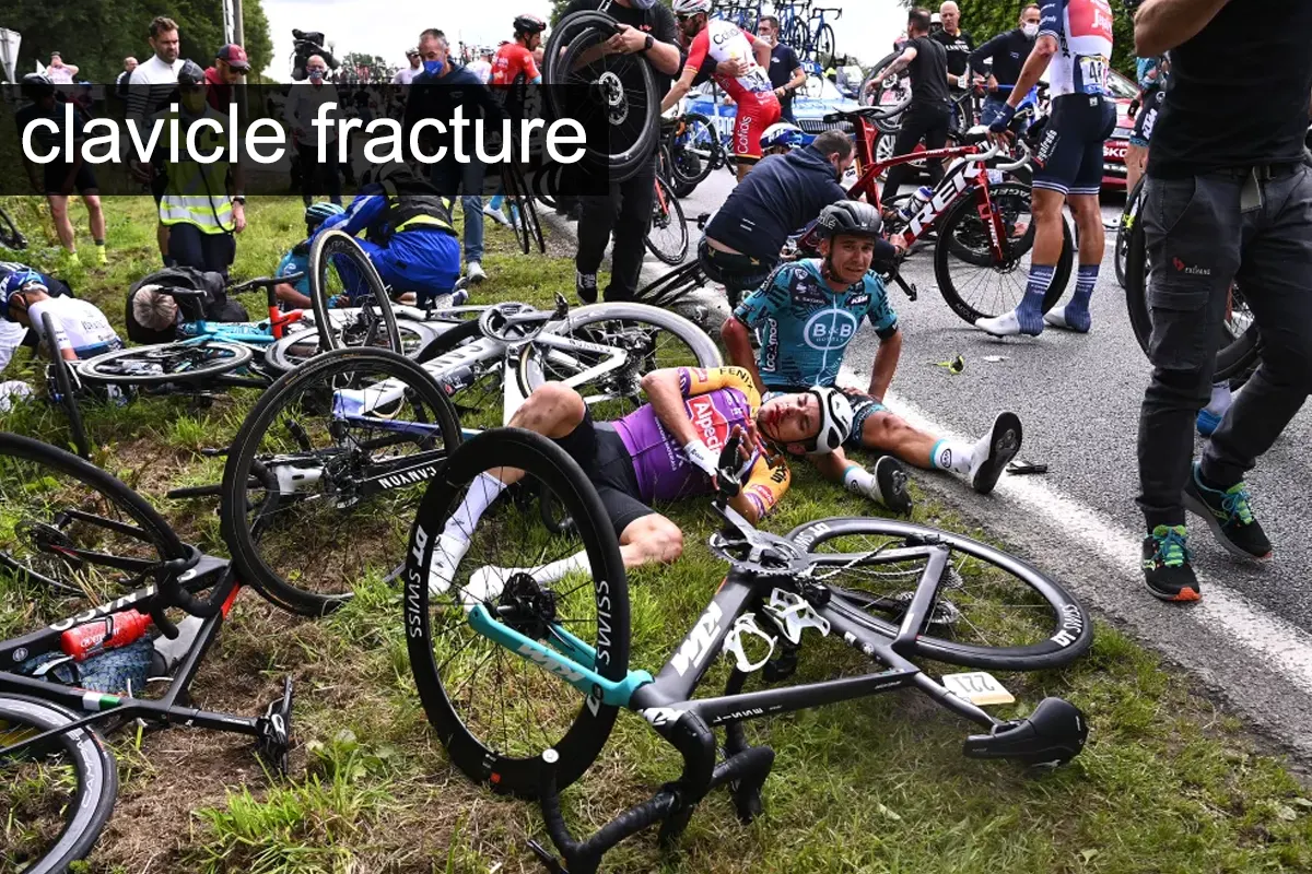 Broken collarbone - every rider needs to learn new when riding